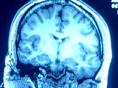 Study finds cell phone use stimulates brain activity | ktvb.com